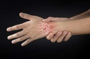 Tout savoir sur la polyarthrite rhumatoïde